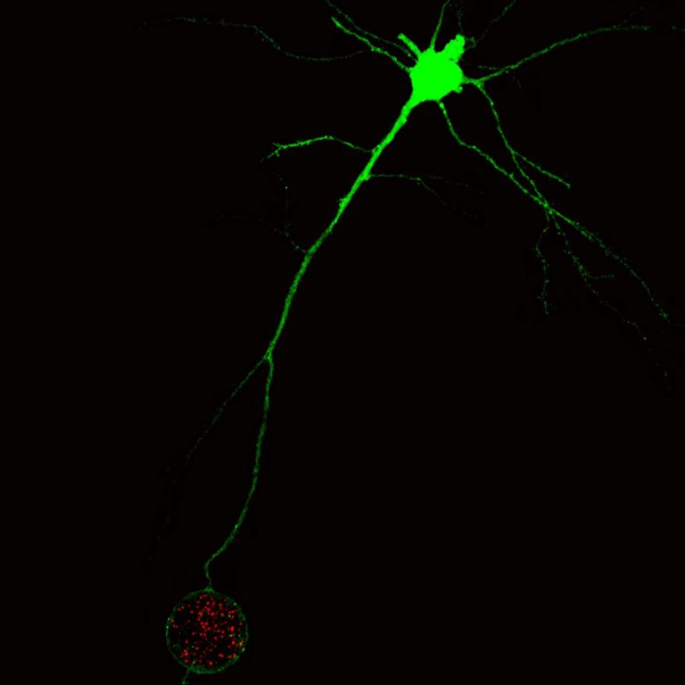 UA researchers hope to cure diseases with a common brain parasite